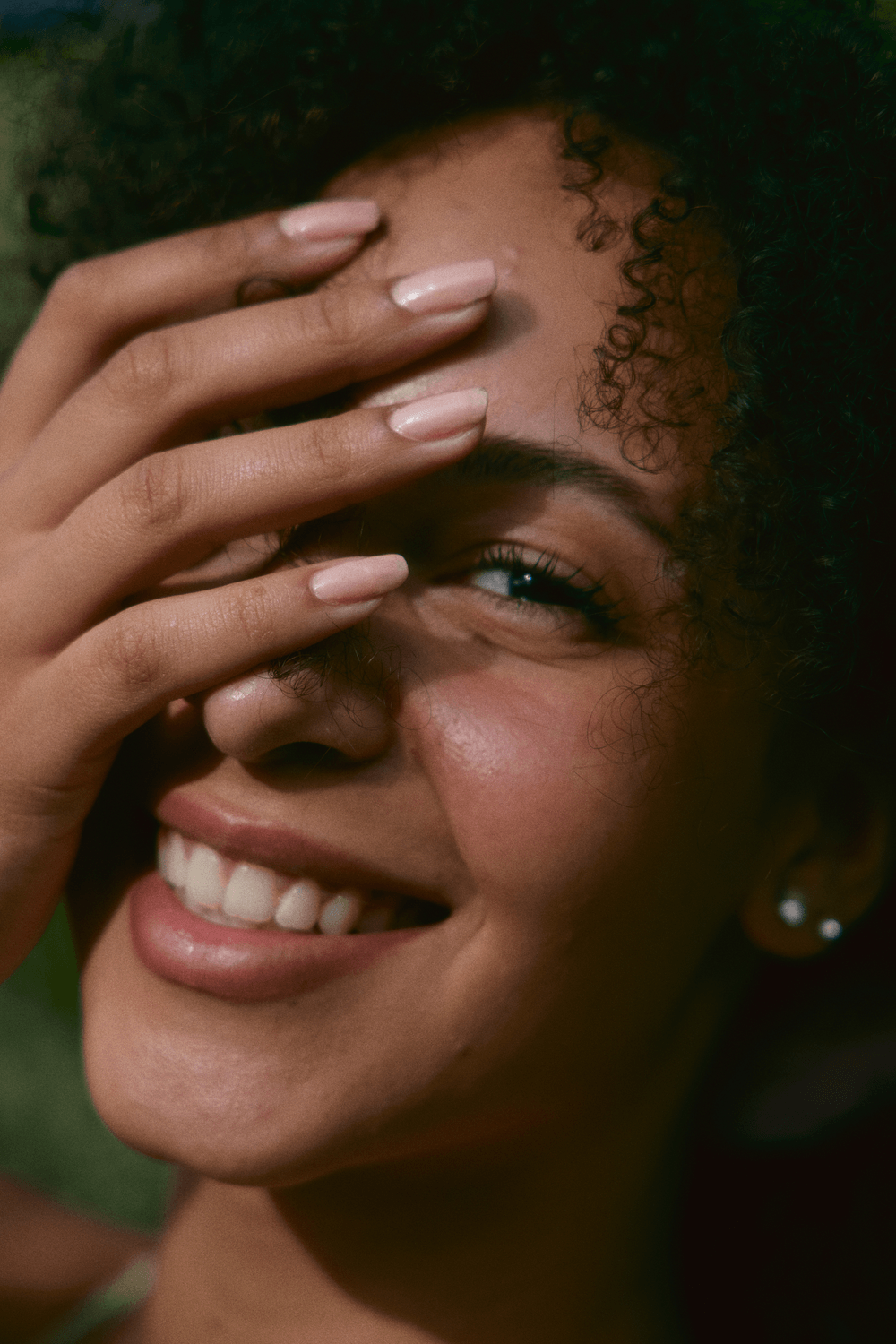 Ultrasound Guided Filler in Woodbury, MN | Petal + Stem